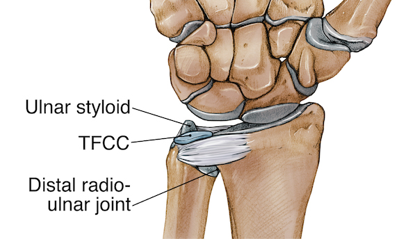 Images of TFCC - JapaneseClass.jp